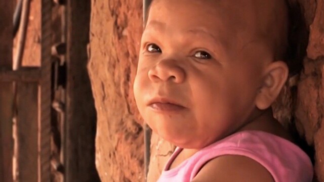 Watch Body Bizarre My Baby Has Eight Limbs S4 E3 Directv