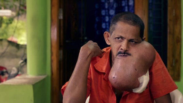 Watch Body Bizarre My Twisty, Bendy, Upside-Down Body S6 E14 | TV Shows ...