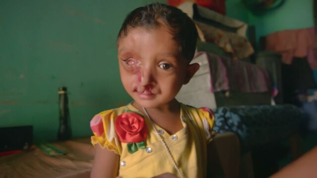 Watch Body Bizarre My Tumor Won't Stop Growing S6 E21 | TV Shows | DIRECTV