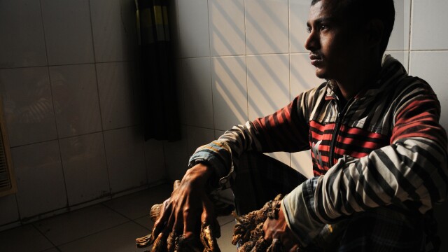 Watch Body Bizarre My Conjoined Twins: Together Forever? S6 Eundefined ...